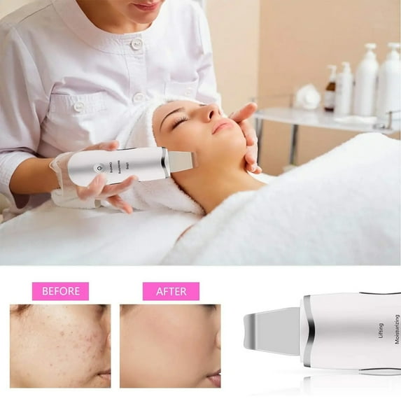 3-in-1 Ultrasonic Facial Spatula for Deep Cleansing & Serum Infusion ...