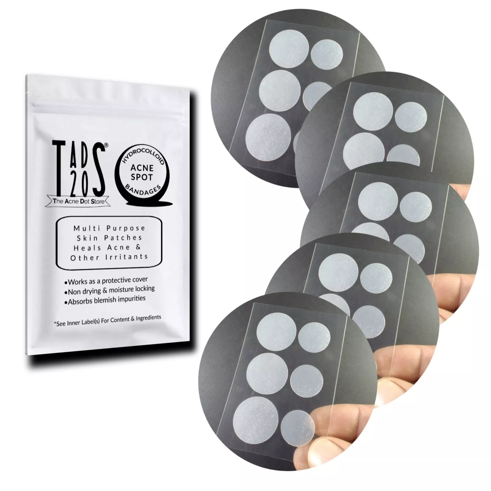 30 Extra Large/Jumbo Large Boils Zits Ingrown Hair, Larger Acne Spot ...