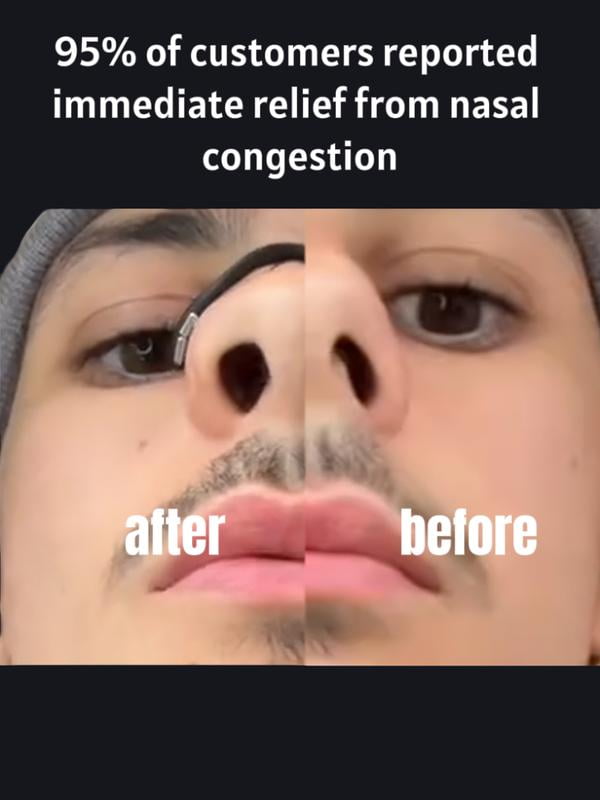 30 pairs Nasal Dilator Magnetic Nasal Stripes – Expand Your Airway for ...