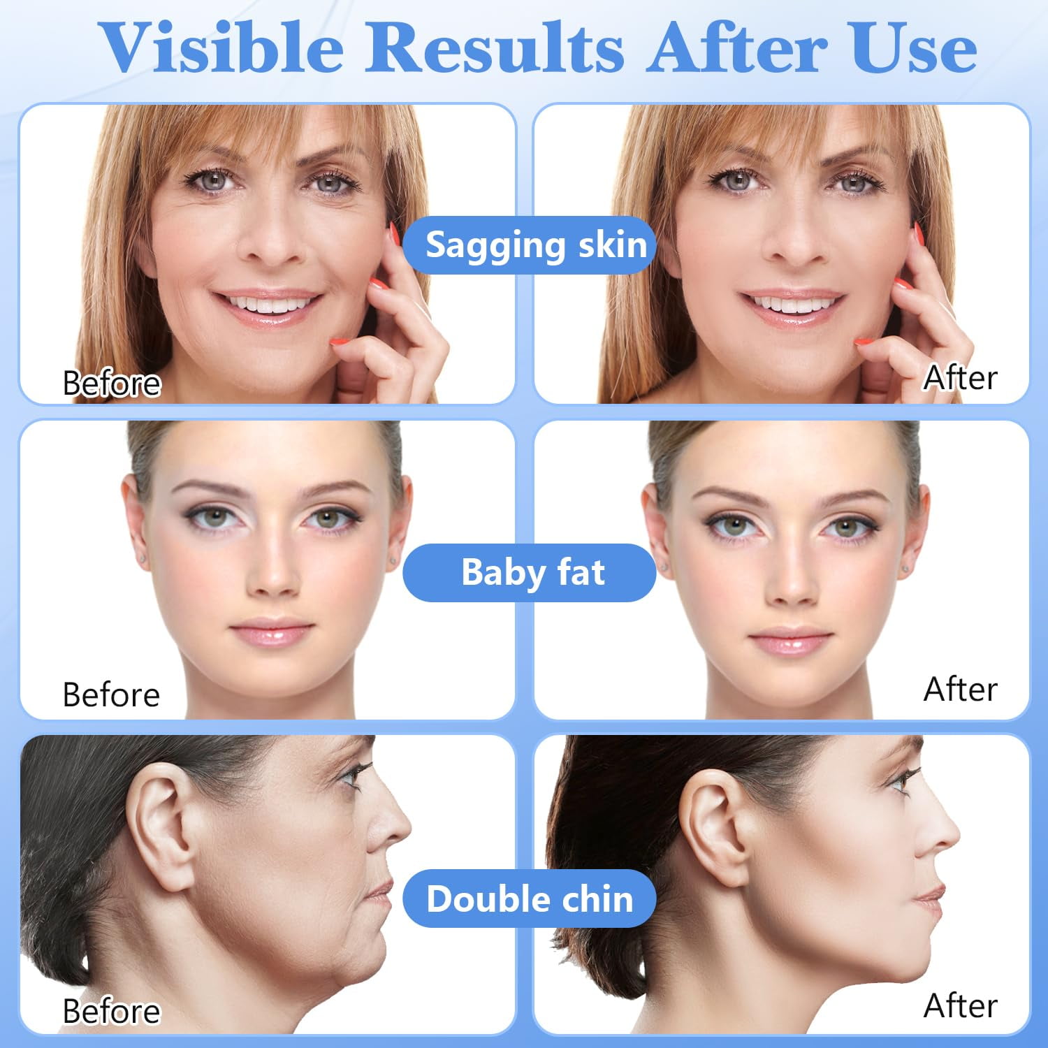 300 PCS Skin Care Face Tape Lifting Invisible Facial Patches for ...