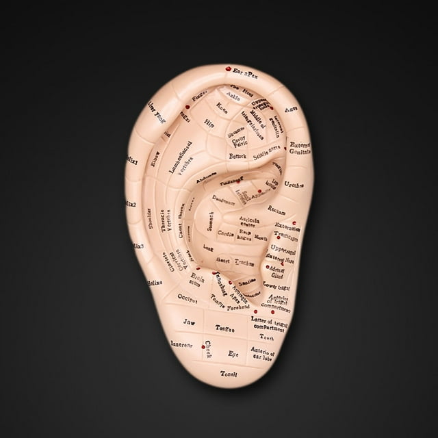 300Pcs Magnetic Ear Patch Auricular Auriculotherapy Acupuncture Seed ...