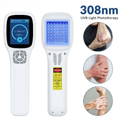 308nm Excimer UV Light Therapy Phototherapy Device for Skin Disorders ...