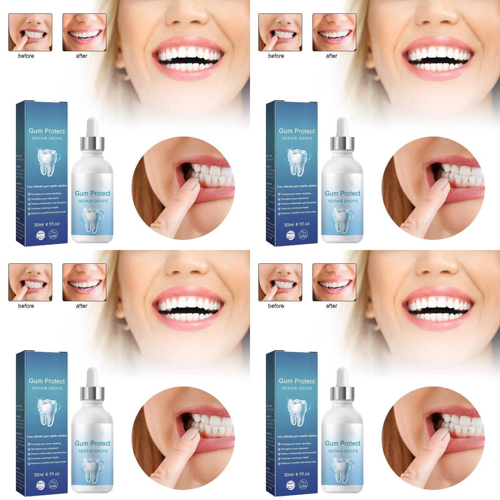 30ml Super Strong Oral Care Solution Effective In Removing And Nose ...