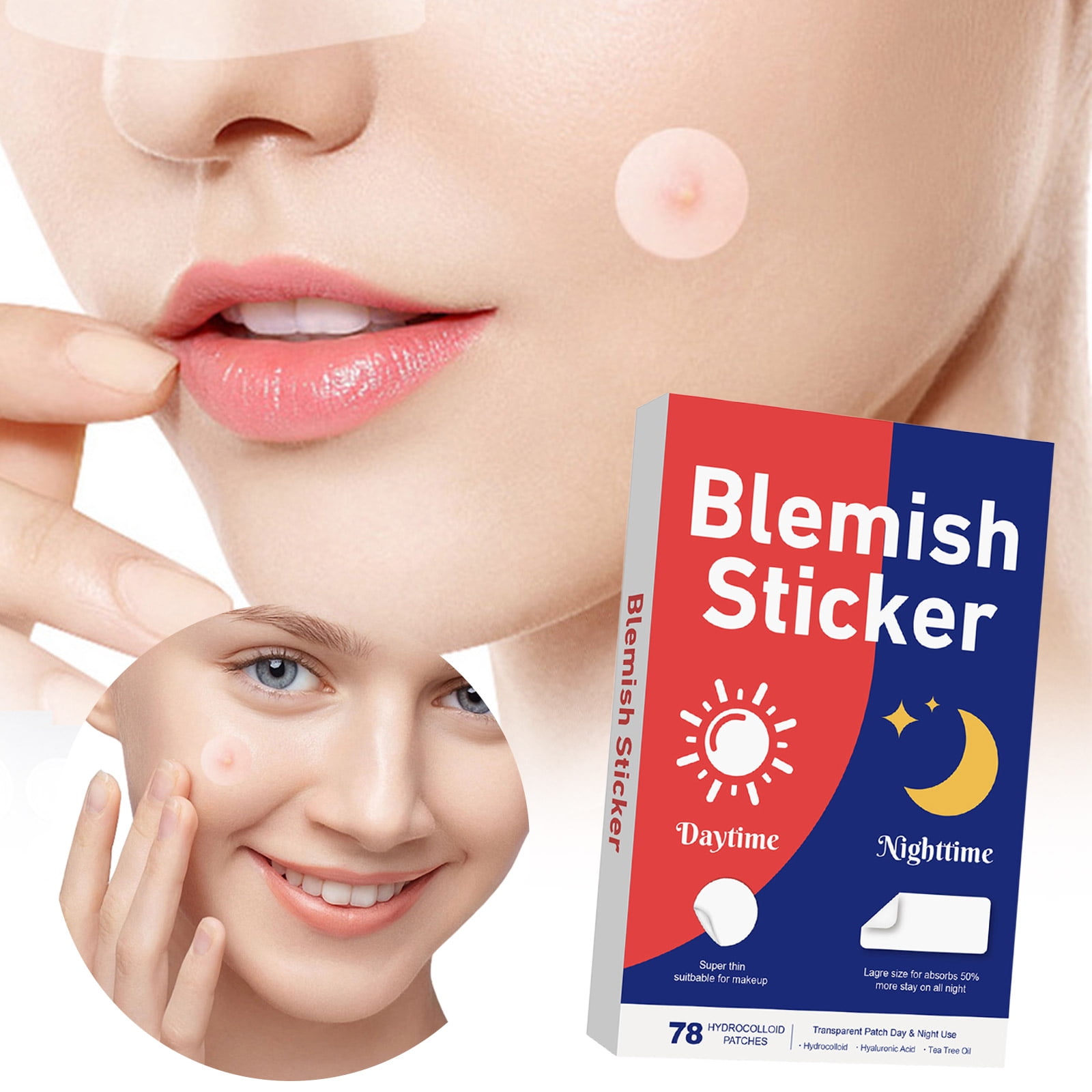 324pc Acne Patches Hydrocolloid Patches to Cover Up Pimples Blemishes ...