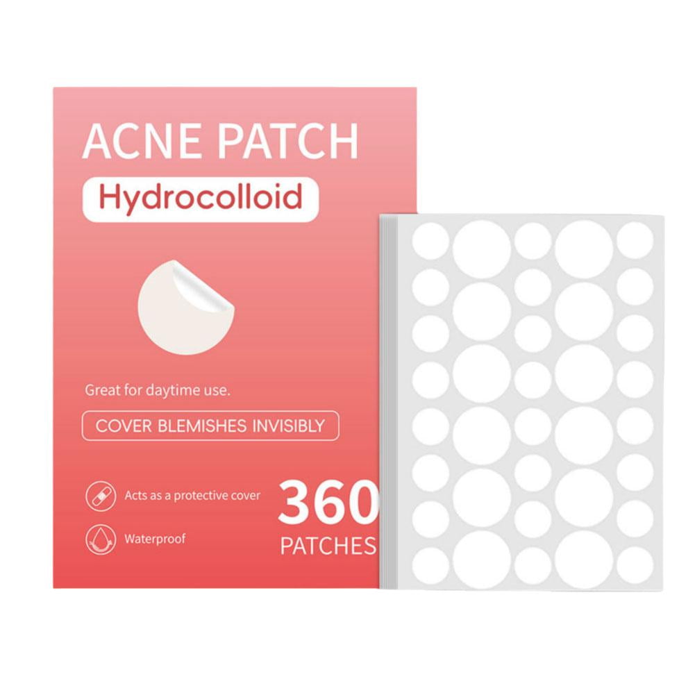 360pcs Acne Patch Mild Non-Irritating Lighten Acne Blackheads Closed ...