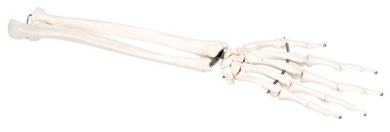 3B Scientific Anatomical Model - loose bones, hand skeleton with ulna ...