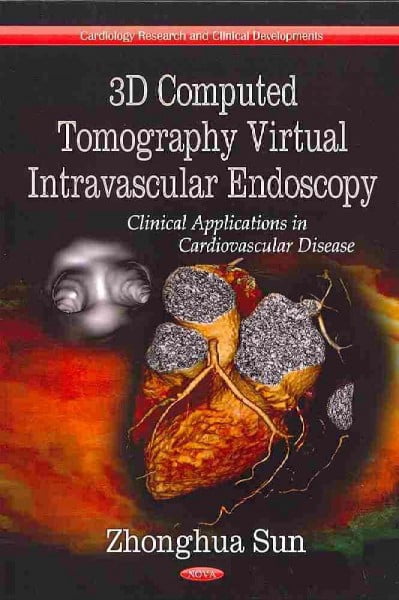 3D Computed Tomography Virtual Intravascular Endoscopy : Clinical ...