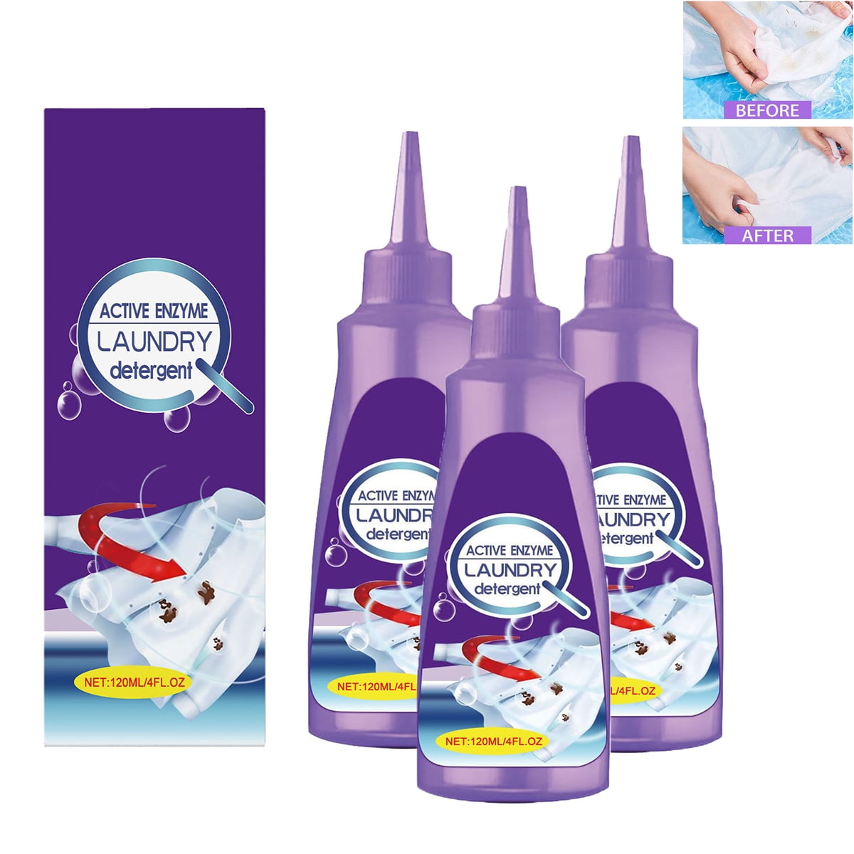3PC Active Enzyme Laundry Stain Remover 120ml,Stain Remover For Clothes ...