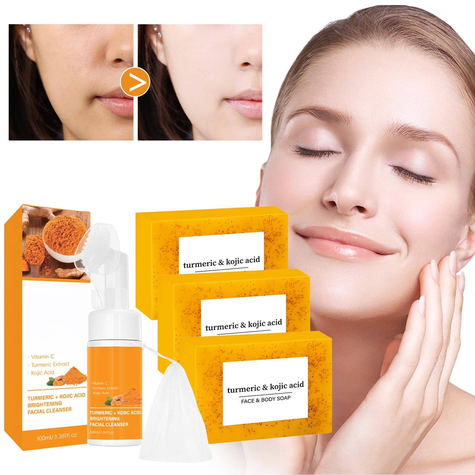 3PCS Lemon Turmeric Acid Soap, Lemon Turmeric Handmade Soap, Turmeric ...