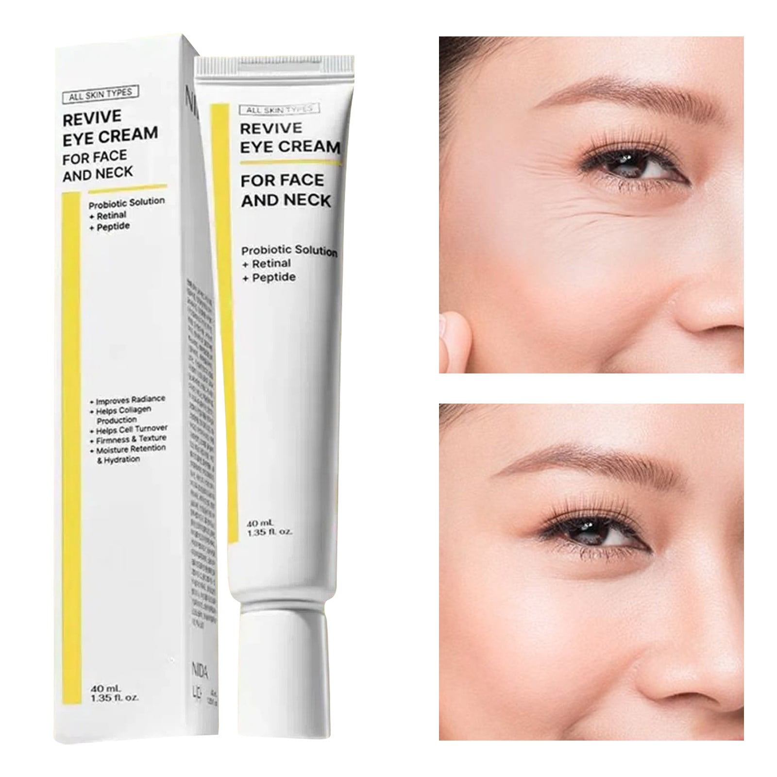 3PCS NIDA Eye Cream & Youthful Moisturizing Cream, Korean NIDA Formula ...