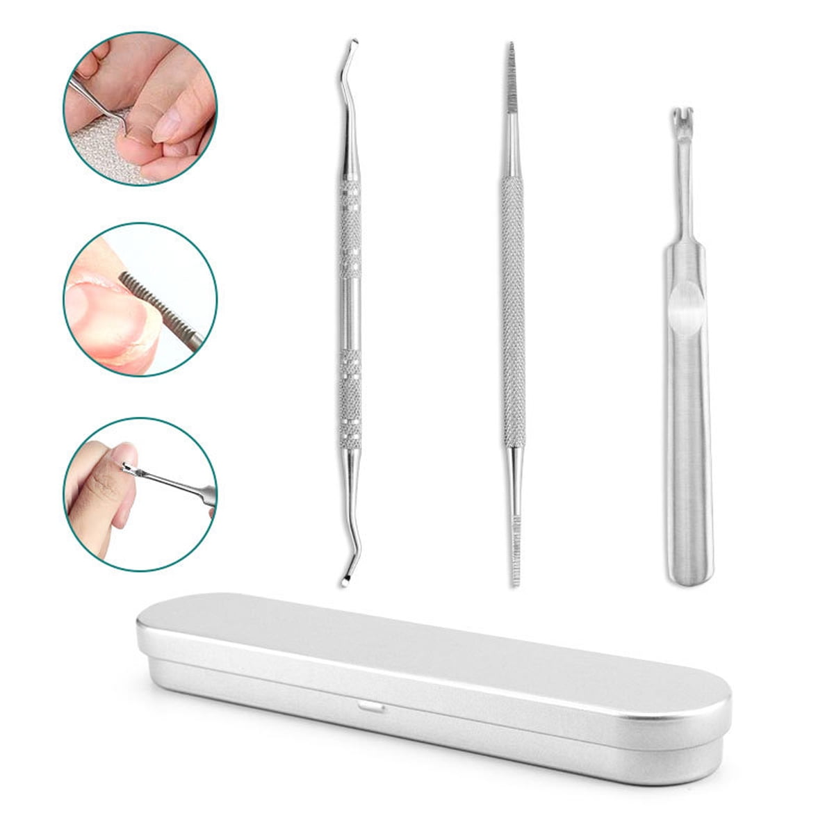 3Pcs Upgraded Ingrown Toenail Tool, Ingrown Toenail File And Lifter ...