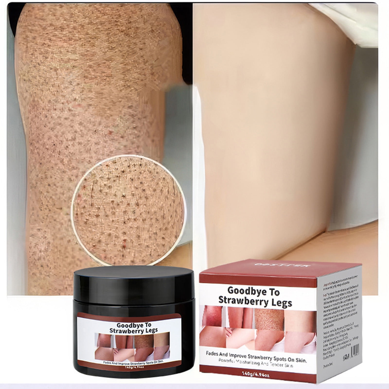3Pc Strawberry Skin Treatment For Women-140G, Rough Bumpy Body Cream ...