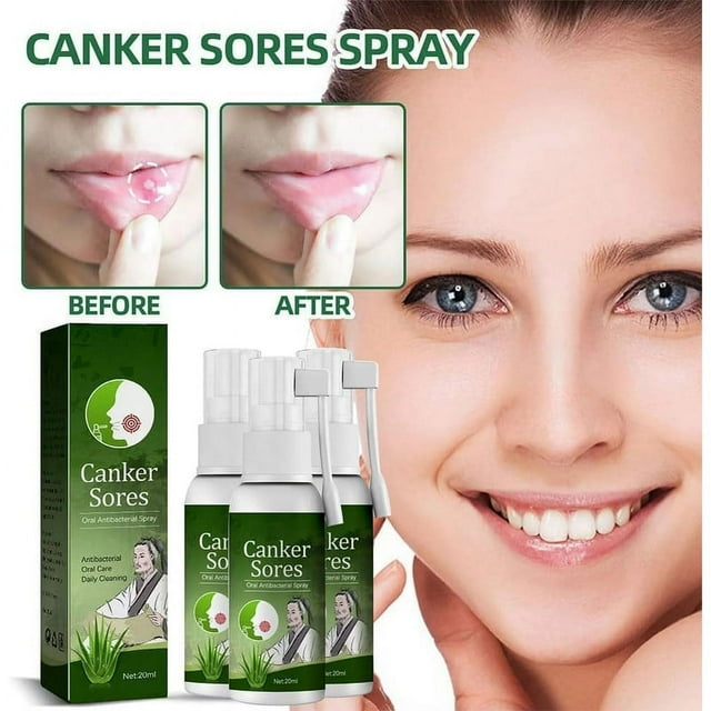 3Pcs Oral Ulcer Relief Spray, Professional Safe Canker Sore Spray，Rapid ...