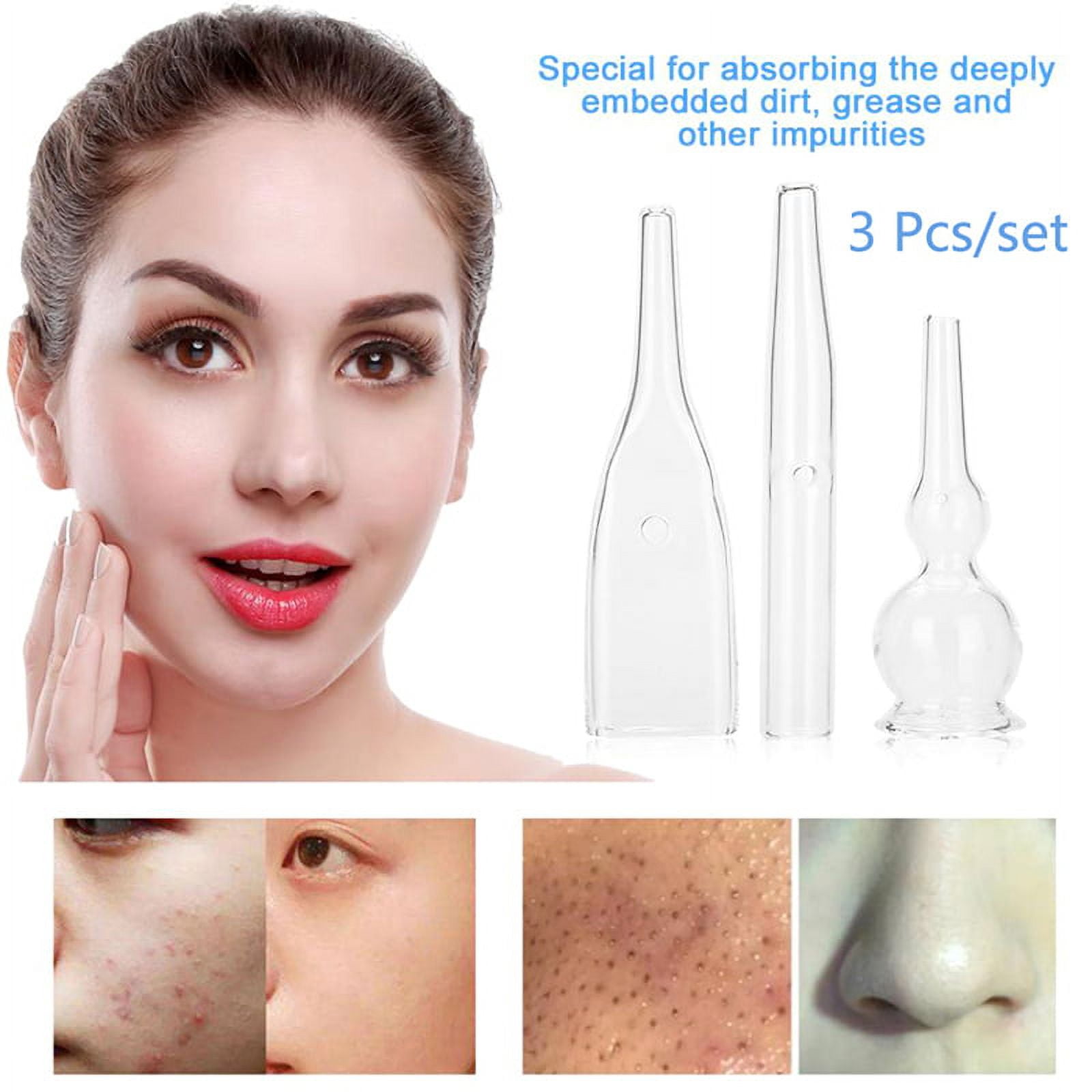 3Pcs/Set Blackhead Removal Glass Pipes Face Pore Cleanser Vacuum ...