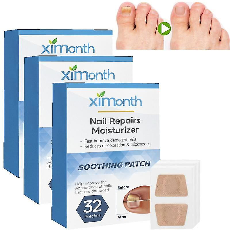 3packs Nail Correction Stickers Ingrown Toenail Corrector Patches ...