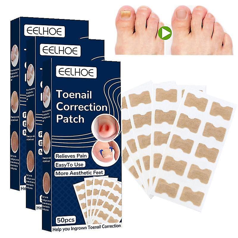 3packs Toenail Corrector Patch Paronychia Treatment Fungus Removal Nail ...