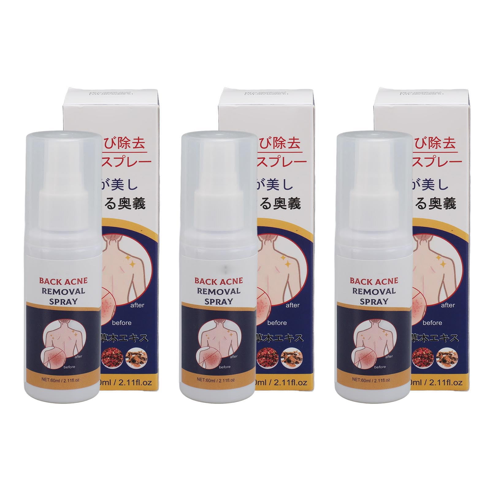 3pcs 60ml Back Care Spray Remove Pimples Oil Control Softening ... 3pcs 60ml Back Care Spray Remove Pimples Oil Control Softening ...
