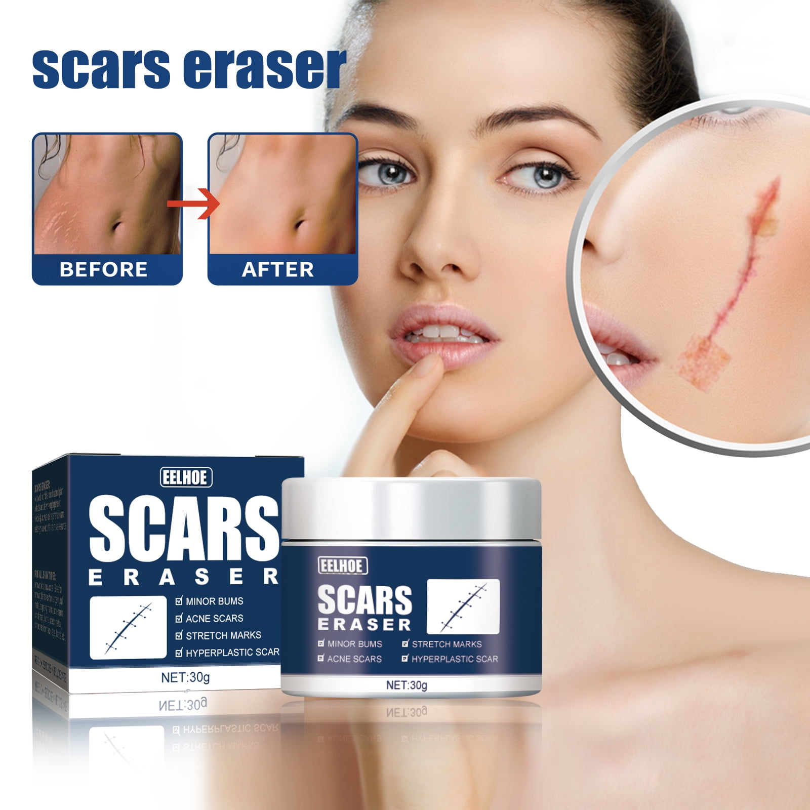 3pcs Scar Balm, Surgery Scar Repair Cold Compress Scar Skin Scar Gel ...