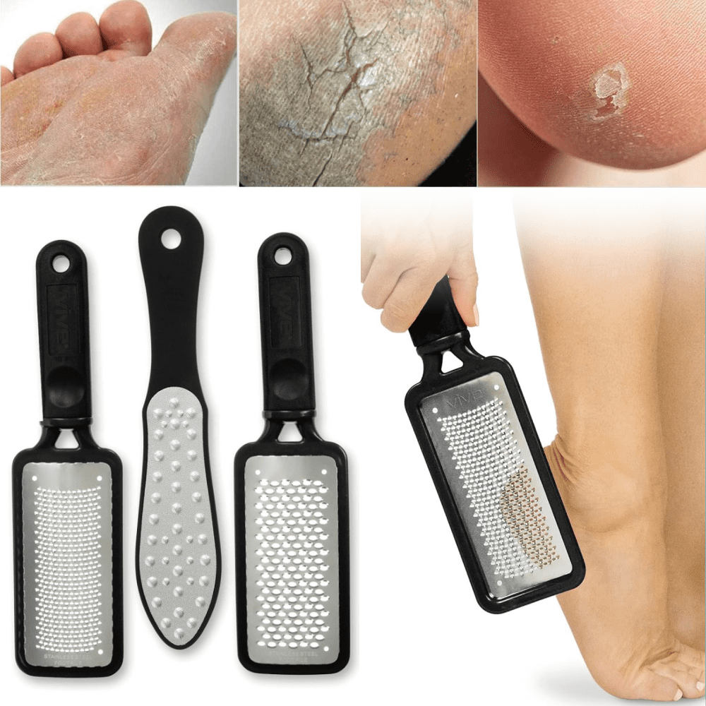 3pcs Stainless Steel Foot File Callus Remover Scrubber Tools, Foot ...