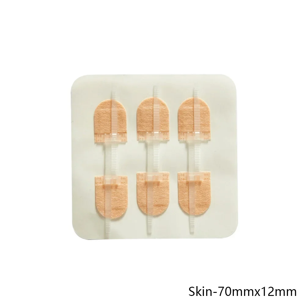 3pcs/set Band-Aid Zipper Tie Wound Closure Patch Hemostatic Patch Wound ...