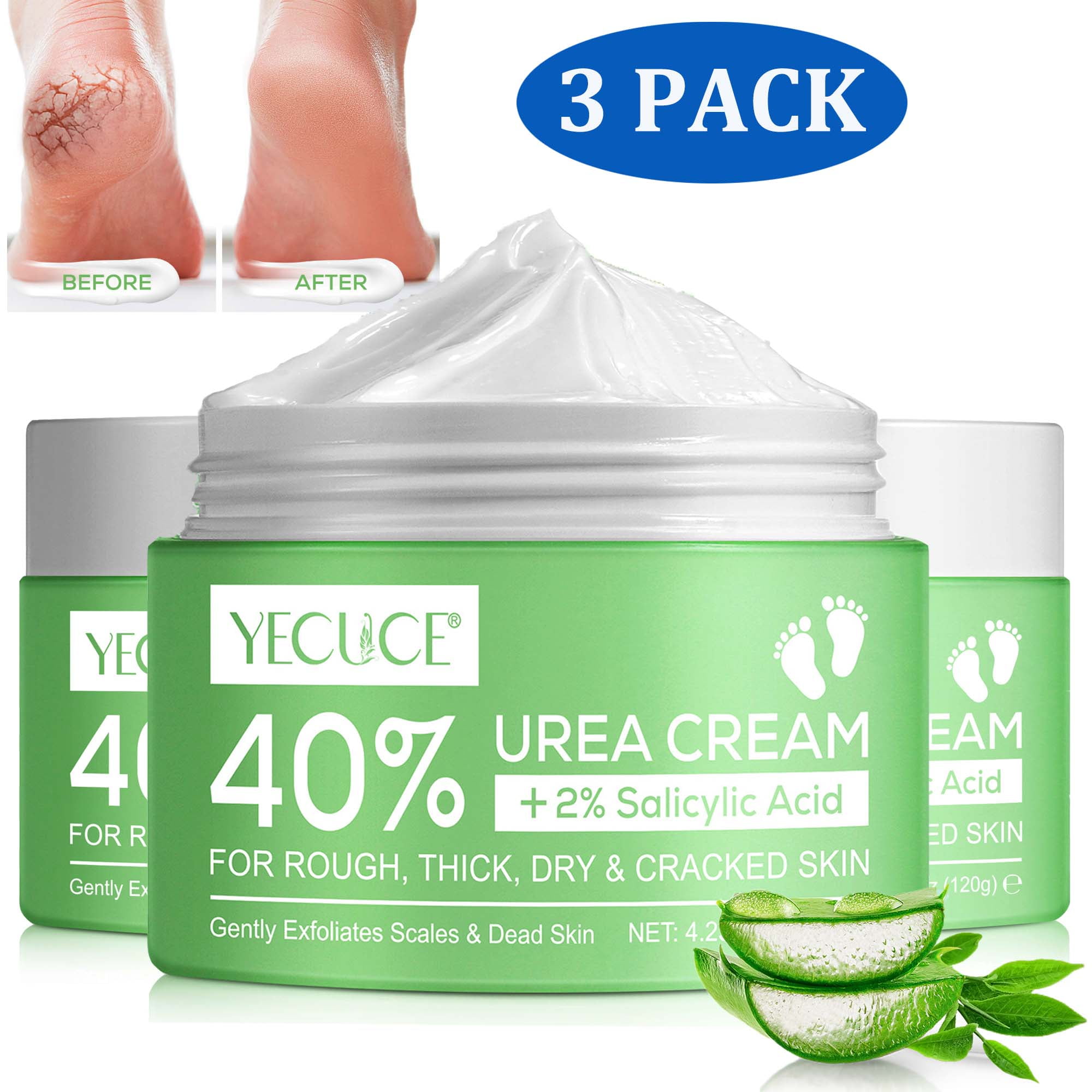 40% Urea Cream 2% Salicylic Acid (3 Pack), Foot Cream Hand Lotion for ...