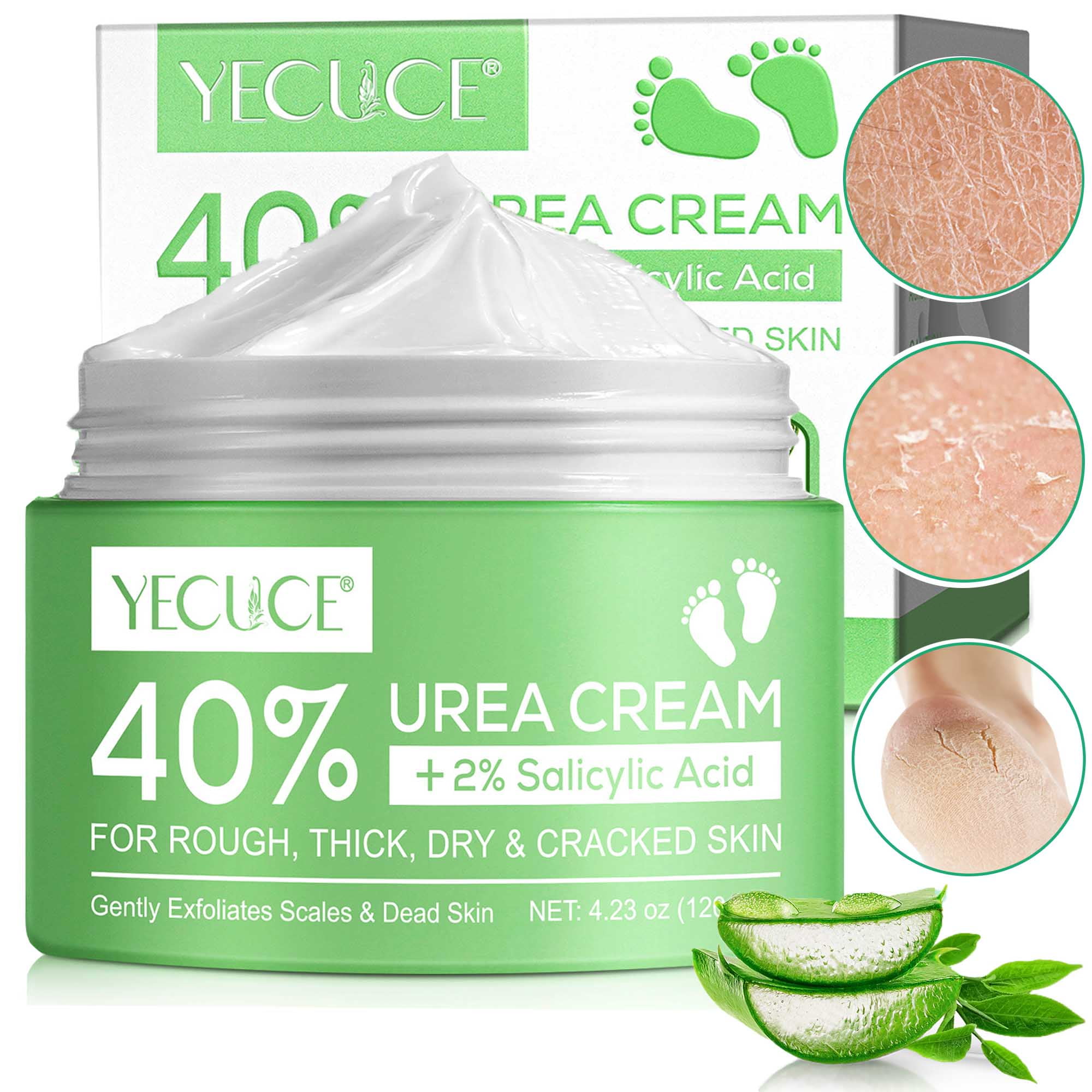 Yecuce 40% Urea Cream, 2% Salicylic Acid, Exfoliate, Hydrate, Repair ...