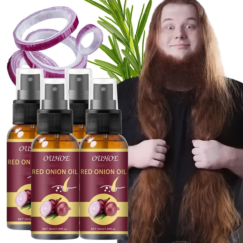 4pcs Red Onion Oil Hair Serum, with Rosemary & Onion, Deeply Moisturizing Hair, for Dry, Split ...