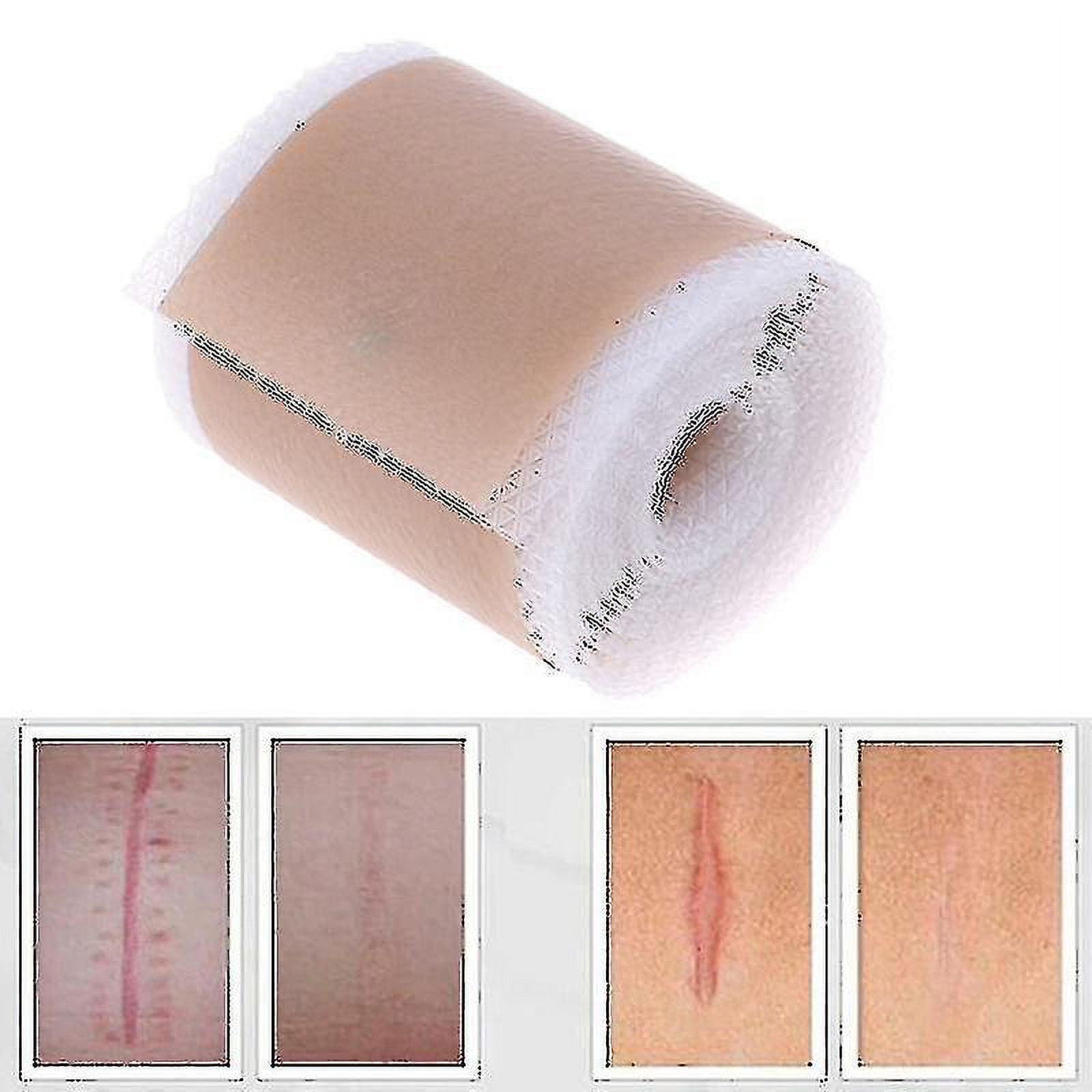 4x150cm Efficient Surgery Scar Removal Silicone Gel Sheet Therapy Patch ...