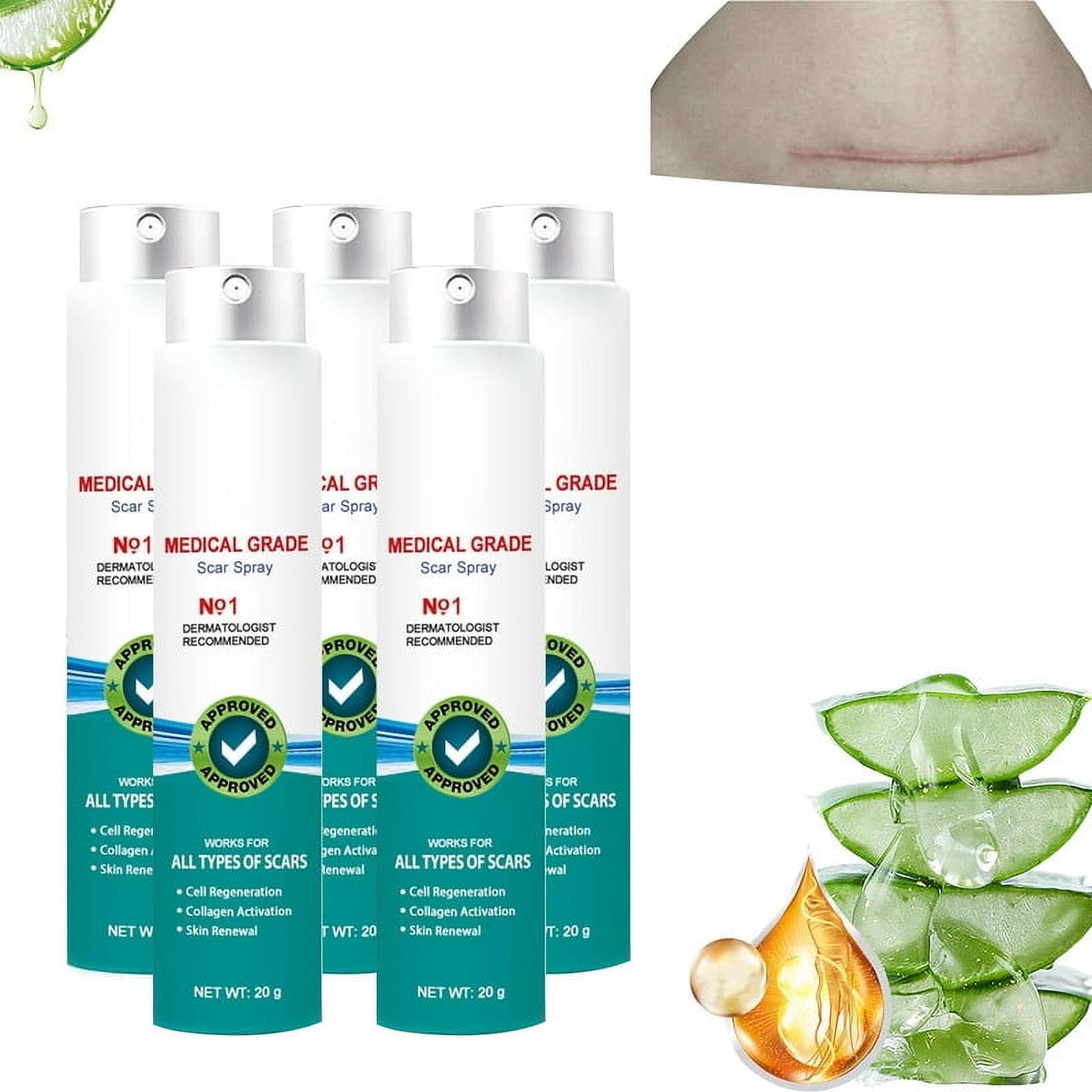 5 Pcs Scar Remove Medical Grade Scar Spray, Acne Scar Treatment, Scar ...