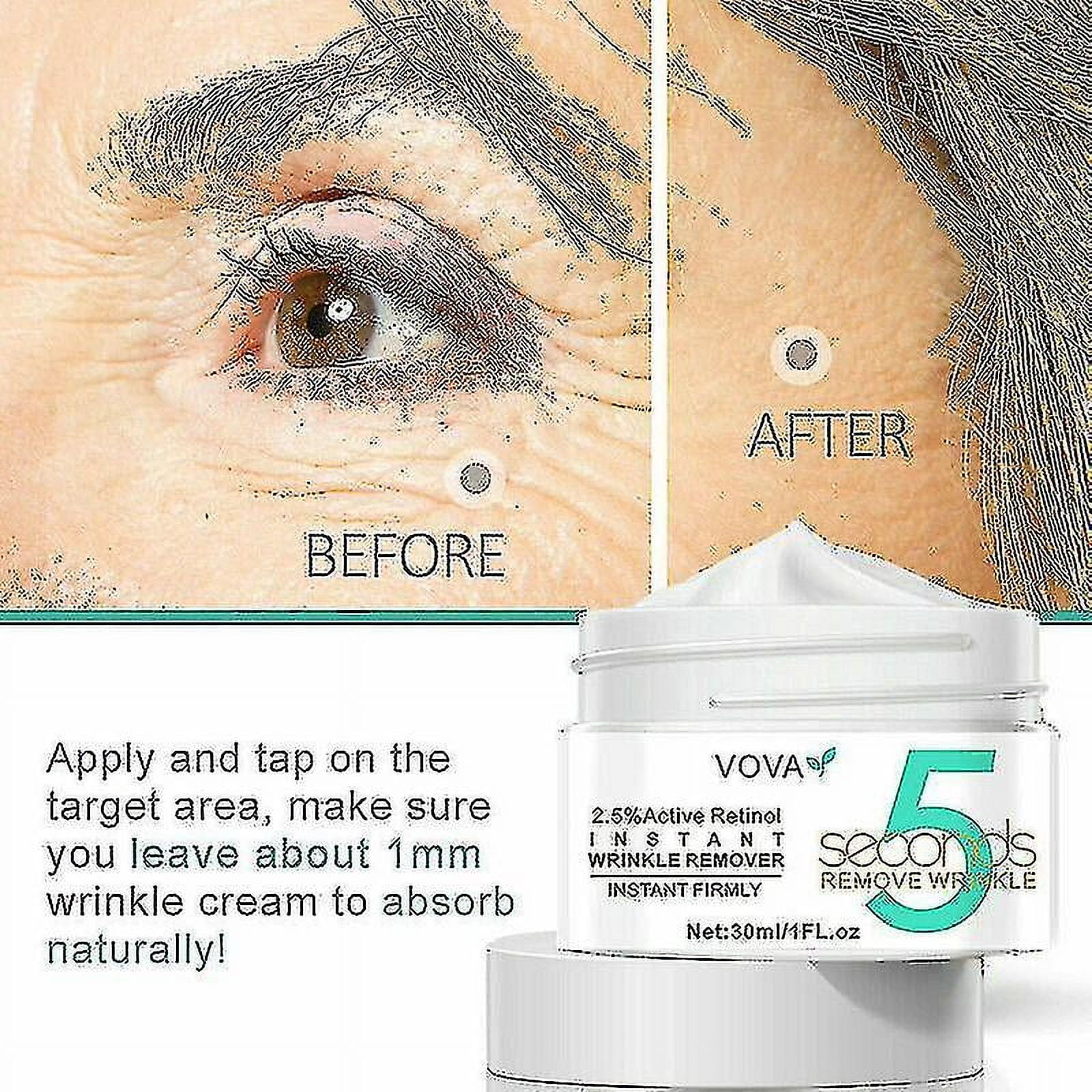 5 Second Wrinkle Remove Instant Face Cream Skin Tightening Anti-aging ...