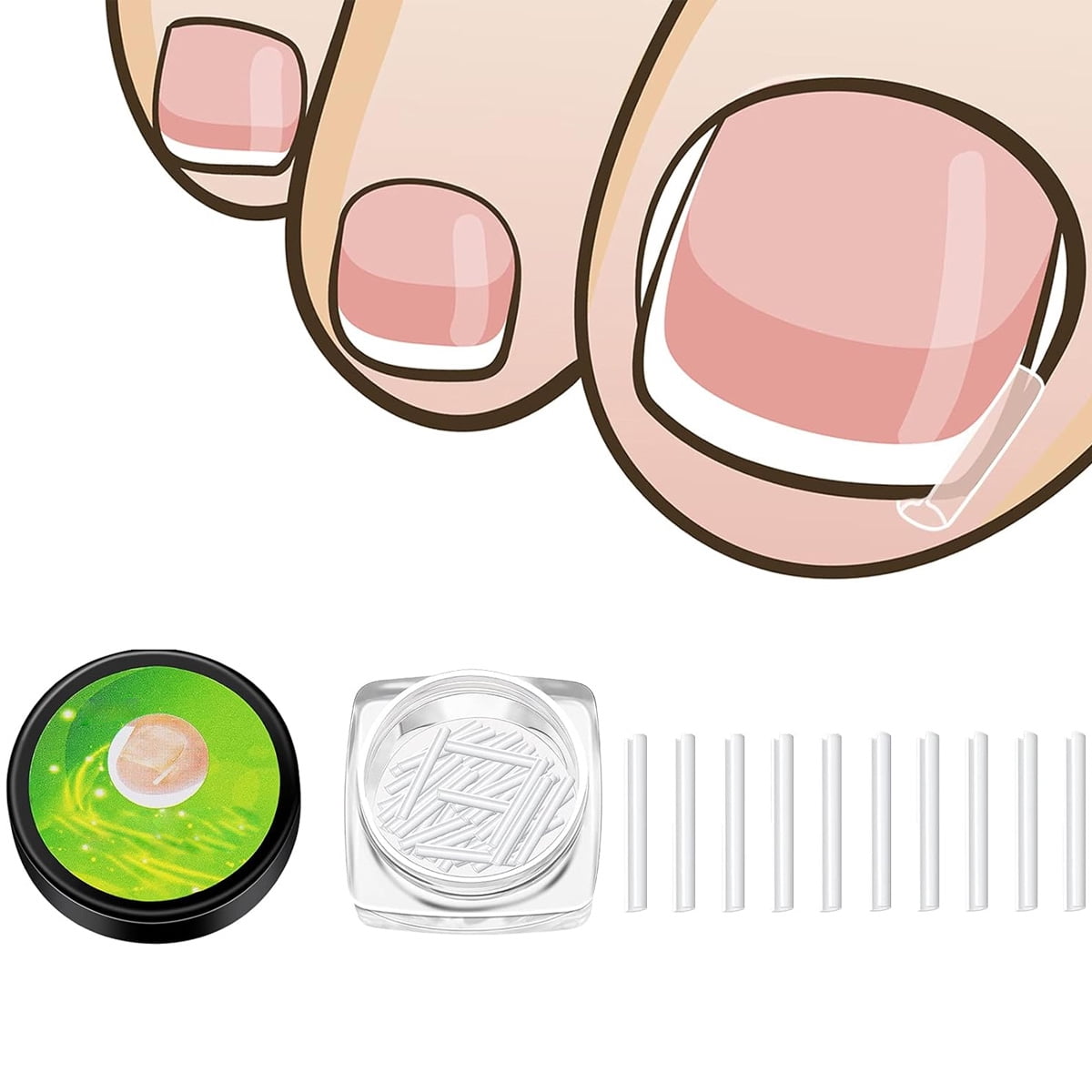 50/100 Pcs Ingrown Toenail Corrector Strips Toenail Correction Patches ...