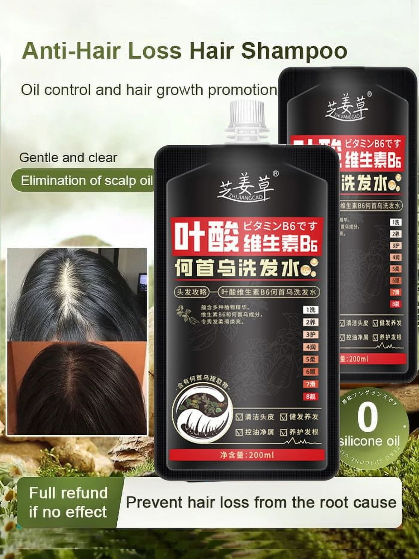 Up to 50% OFF, Topliu Folic Acid B6 Shampoo, Oil Control Antis-dandruff ...