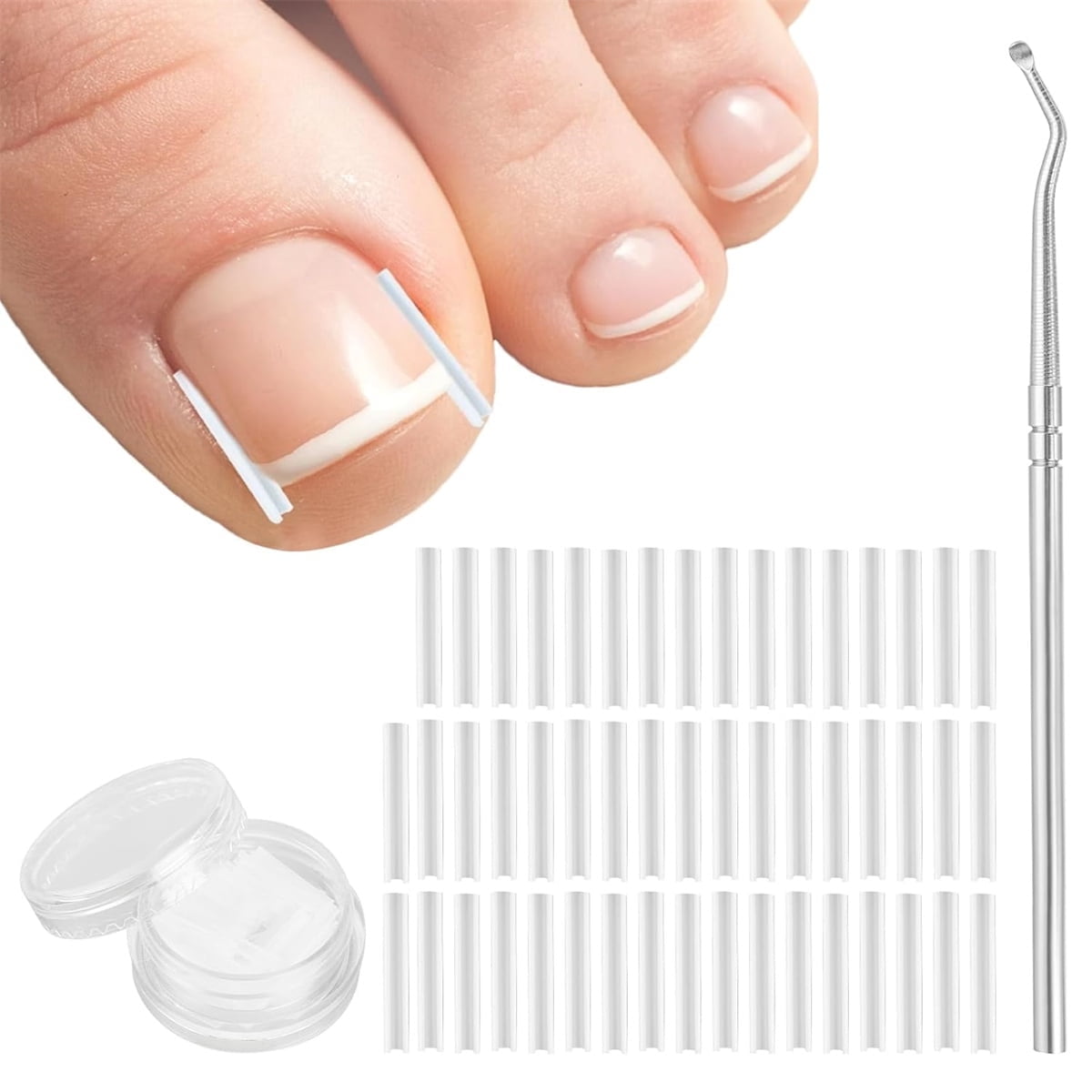 50 Pcs Ingrown Toenail Correction Strip,Toenail Embedding Tool with ...