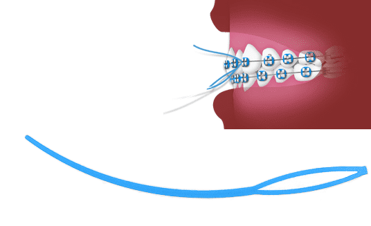 500/pack Dental Floss Threaders Curved Smooth Edges Threader ...