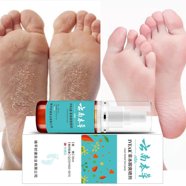 La Bella Deodorizing Refreshing Foot Gel 12 oz - Walmart.com