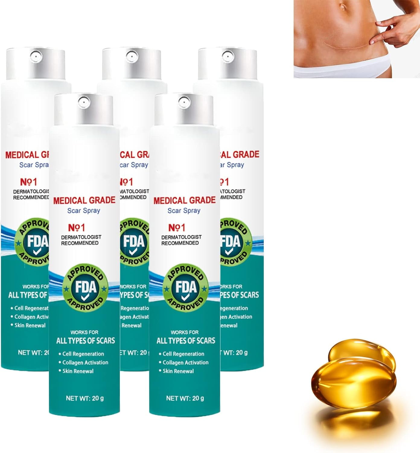 5PCS-Scar Removal Medical Grade Spray, Pregnant Women Stretch Mark ...