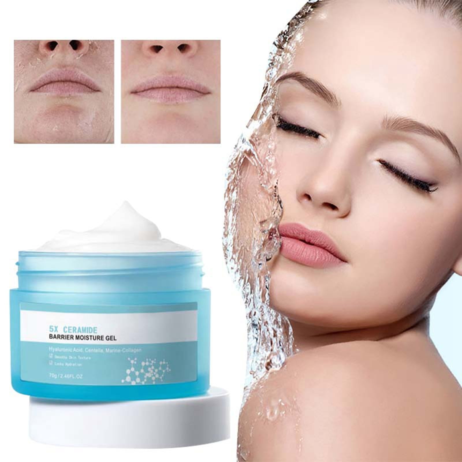 5X Ceramide Barrier Moisture Gel 70g/2.46fl.oz (Pack of 3) - Hyaluronic ...