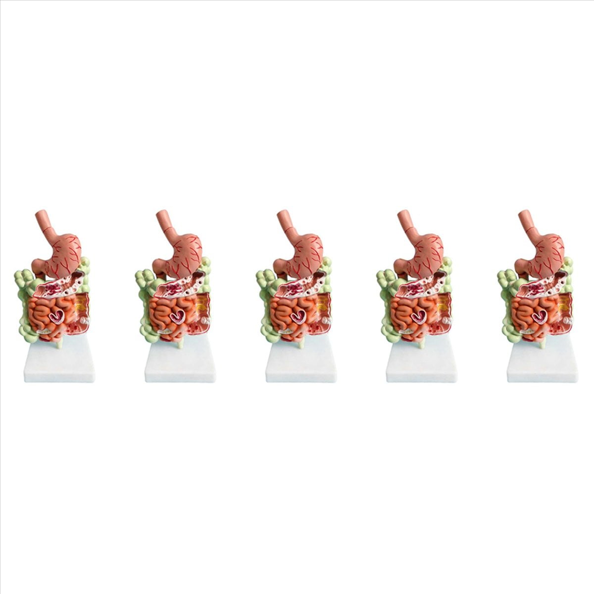 5X Human Digestive System Model Stomach Anatomy Large Intestine Cecum ...