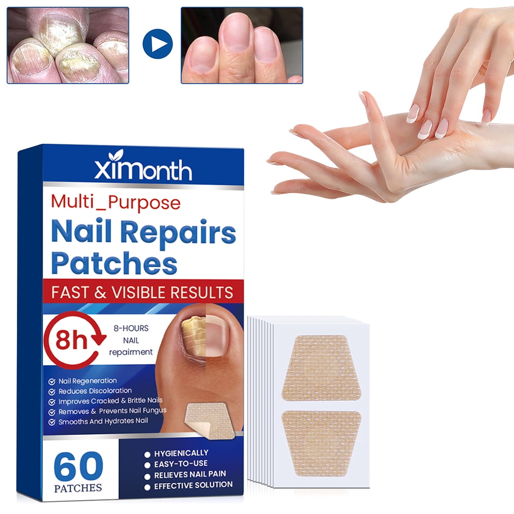60Pcs Nail Ingrown Correction Stickers Breathable Nail Repair Patches ...