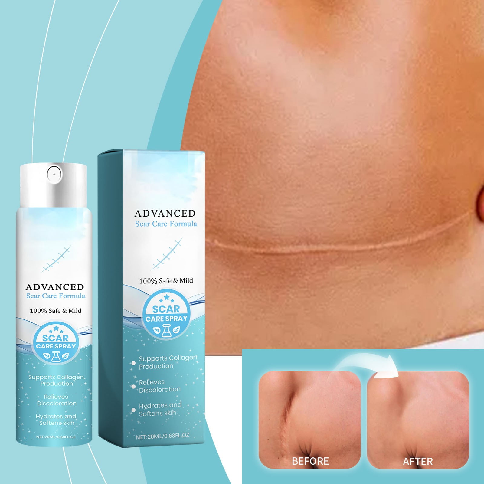 60Th Birthday Gifts For Women Scar Care Spray 20Ml Scar Mild ...