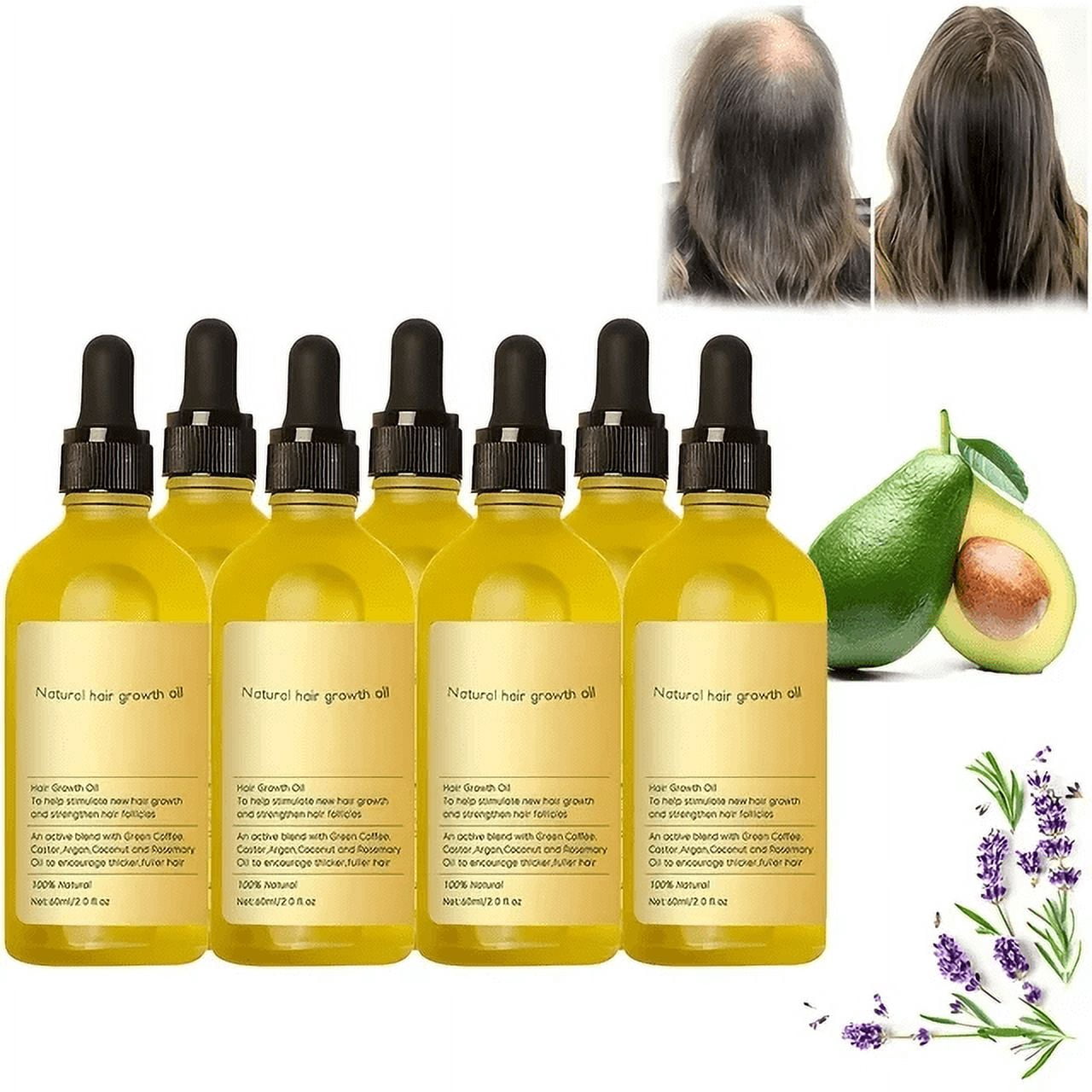 7 PCS Veganic Natural Hair Growth Oil, Rosemary Oil For Hair Growth ...