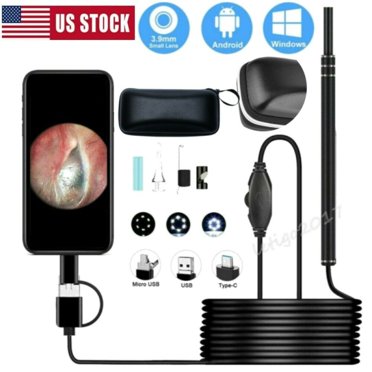 Bebird Wireless Ear Wax Cleaner Otoscope System with 30x Zoom for ...