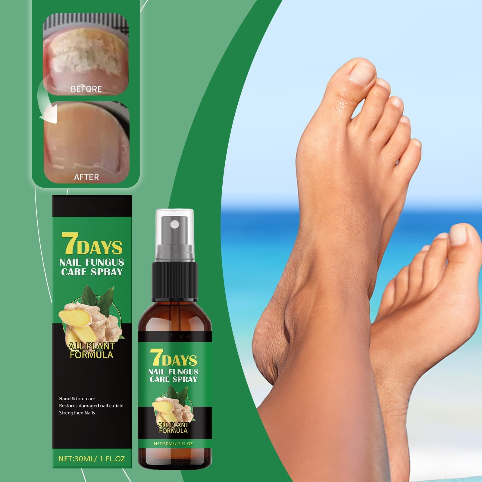 7days Nail Fungus Treatment Essence Serum Anti-infection Onychomycosis Paronychia Hand Care ...
