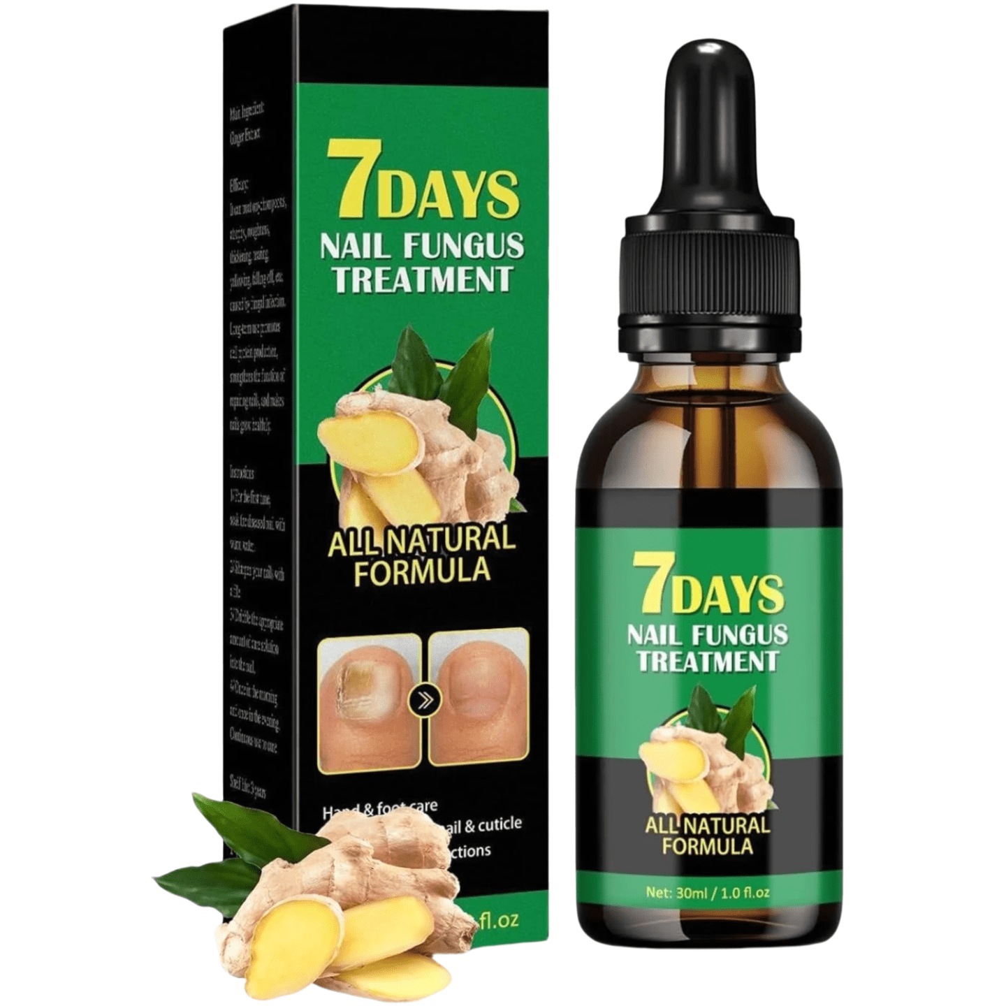 7days Nail Fungus Treatment Essence Serum Anti-infection Onychomycosis Paronychia Hand Care ...
