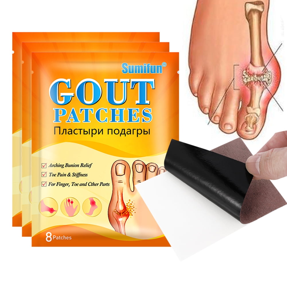 Gout Treatment