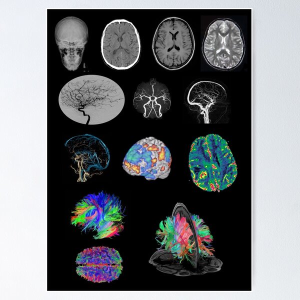 A NEW Brain Imaging Poster - Walmart.com
