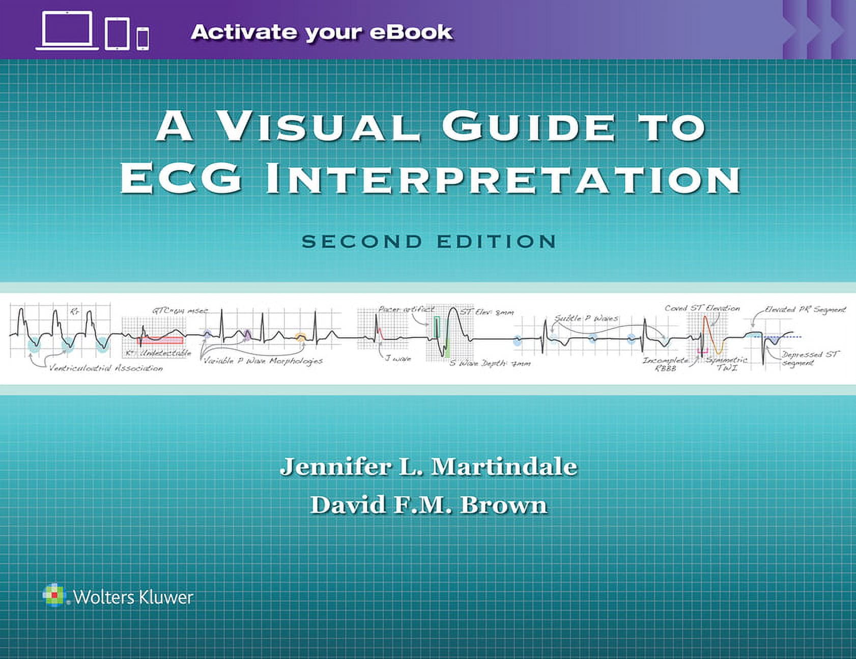A Visual Guide to ECG Interpretation, 9781496321534, Paperback, Second ...