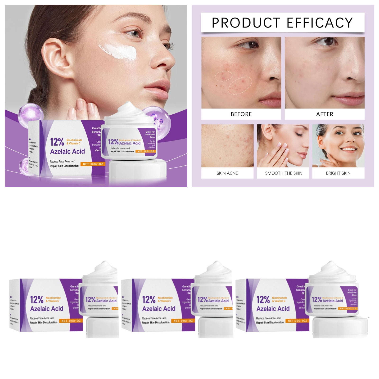 A-zelaic Acid Blemish Cream – 10% Concentrate for A*cne-Prone Skin ...