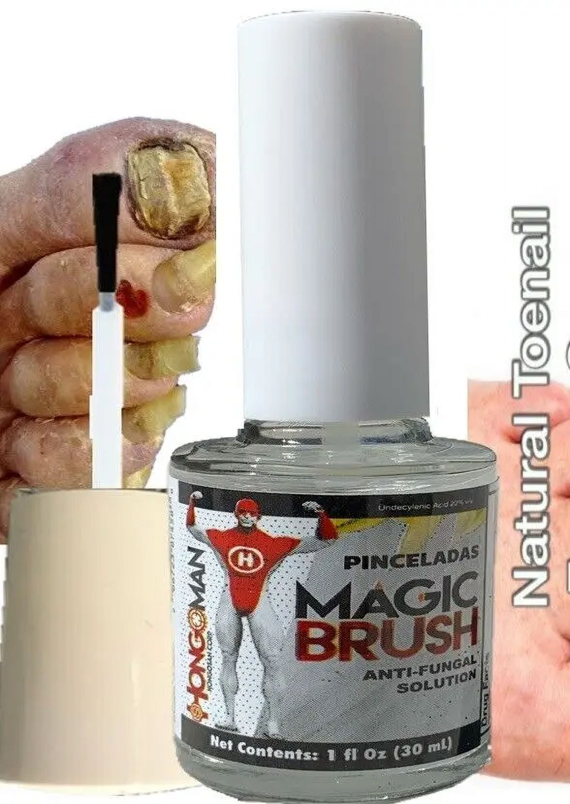 ANTI-FUNGAL MAXIMUM STRENGTH TOENAIL FUNGUS ATHLETES FOOT FUNGI NAIL ...