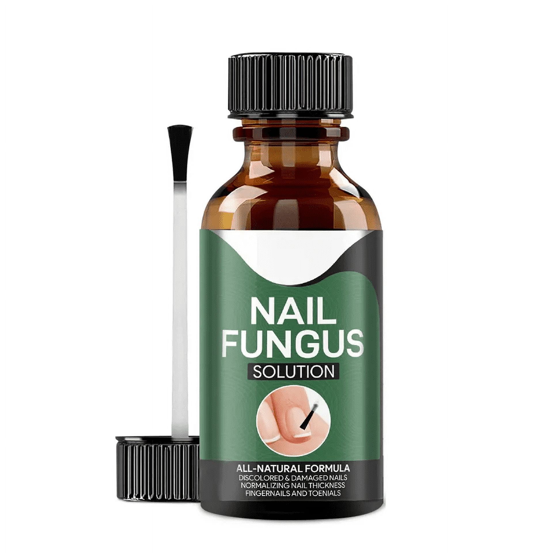 Anti Fungal Treatment Extra Strength Toenail Fungus Fungi Xs Nail